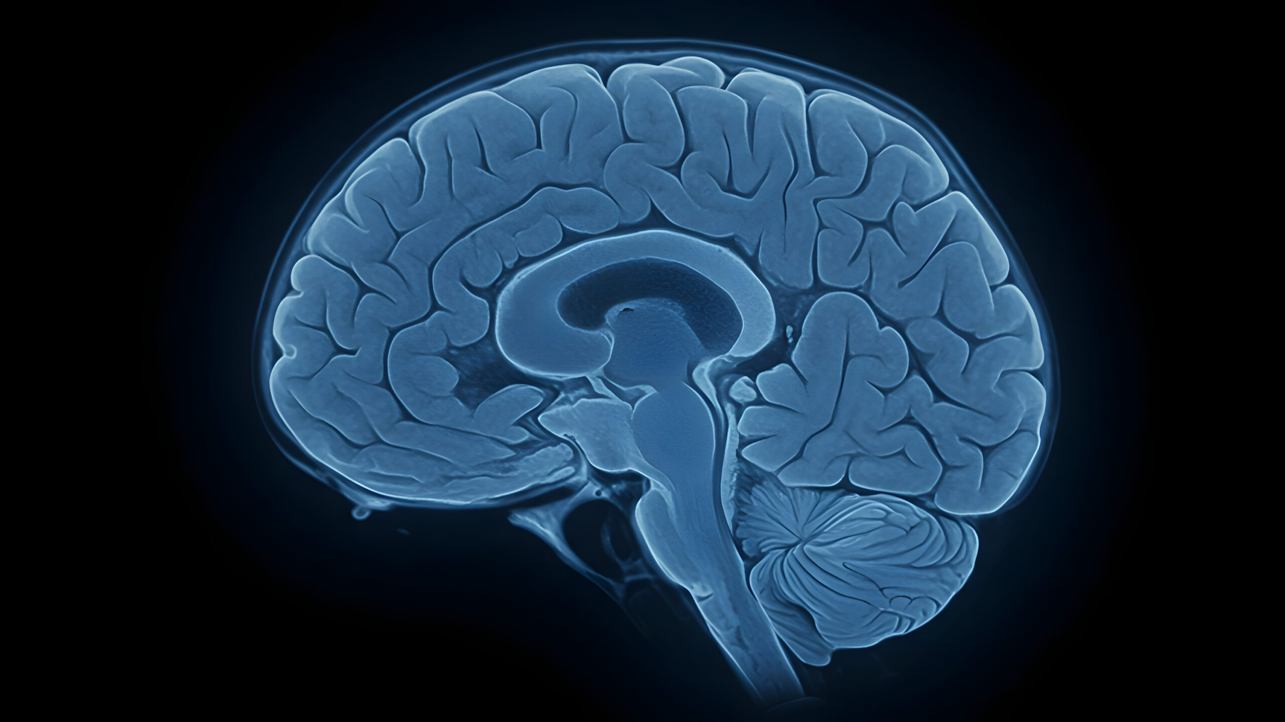 The Islamic Legislative Understanding of Intelligence (ʿAql) - troid ...